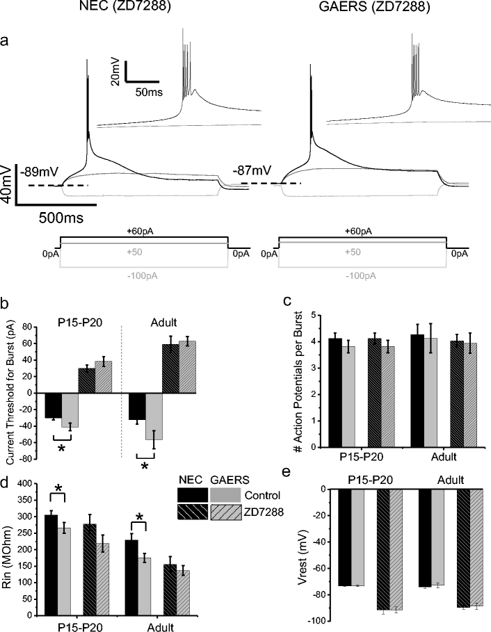 Thalamocortical neurons display suppressed burst-firing due to an ...