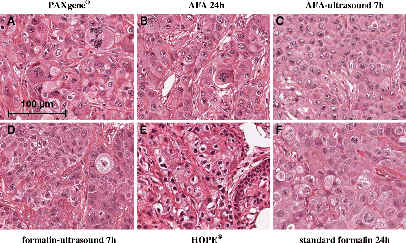 Systematic comparison of tissue fixation with alternative fixatives to ...