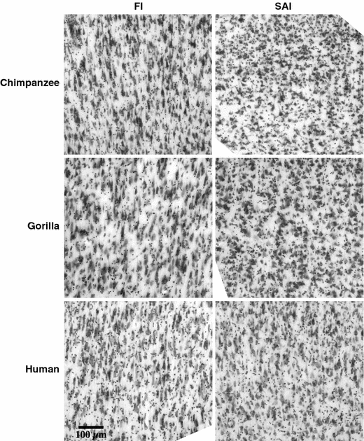 The von Economo neurons in frontoinsular and anterior cingulate cortex ...
