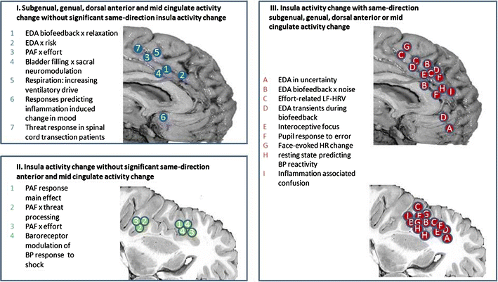 Conjoint activity of anterior insular and anterior cingulate cortex ...