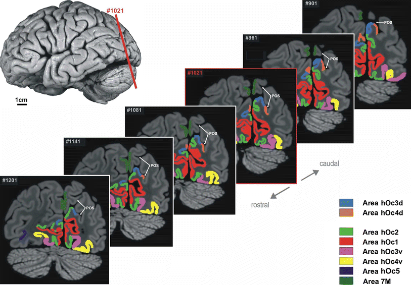 Cytoarchitectonic mapping of the human dorsal extrastriate cortex ...