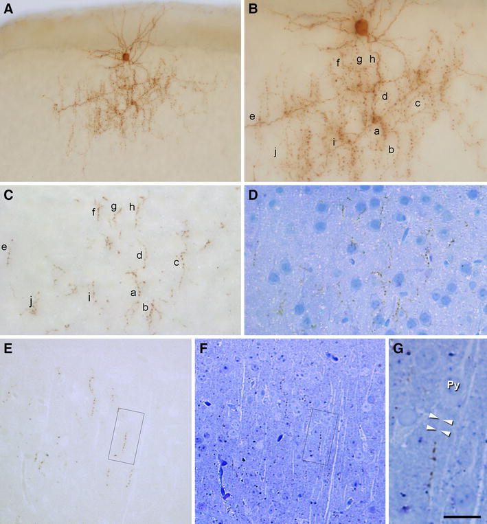 Spatial distribution of neurons innervated by chandelier cells ...