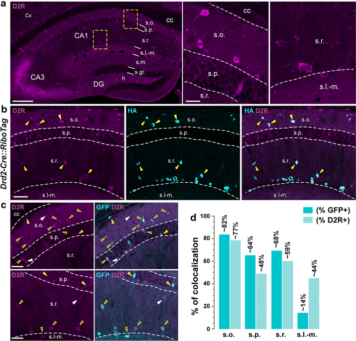 Anatomical and molecular characterization of dopamine D1 receptor ...