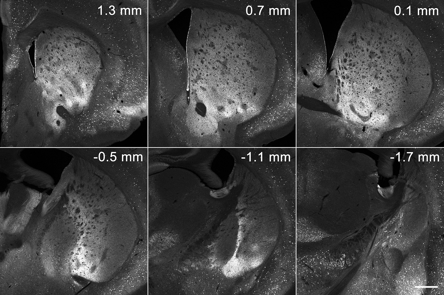 Striosome-based map of the mouse striatum that is conformable to both ...