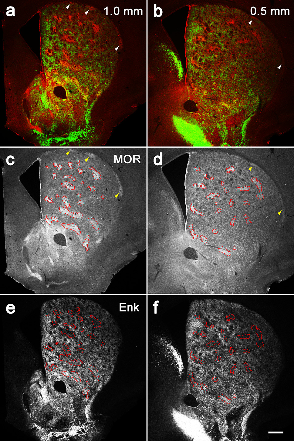 Striosome-based map of the mouse striatum that is conformable to both ...