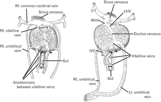 Congenital portosystemic venous shunt | SpringerLink