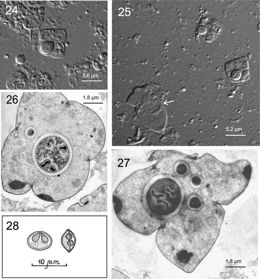 Study of Myxosporea (Myxozoa), infecting worldwide mullets with ...