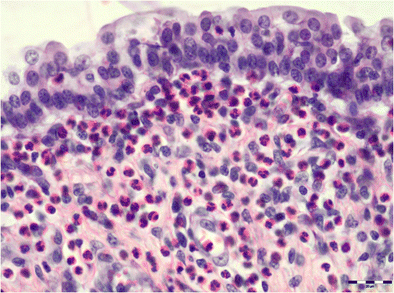 Pearsonema plica ( Capillaria plica) infection and associated urinary ...