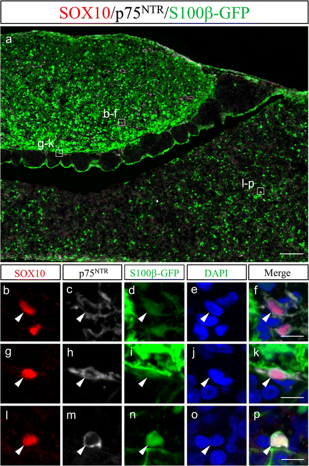 SOX10-positive cells emerge in the rat pituitary gland during late ...
