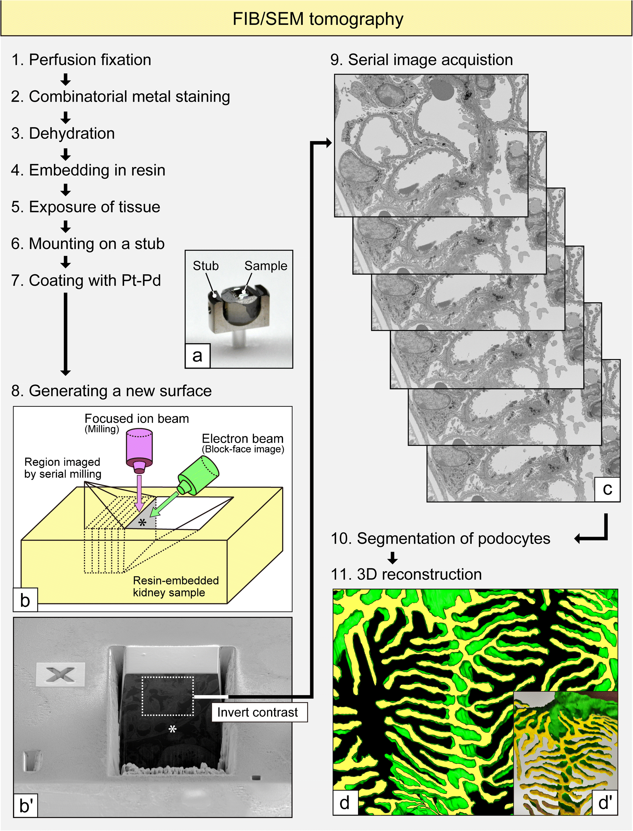 Three-dimensional imaging of podocyte ultrastructure using FE-SEM and FIB-SEM tomography ...