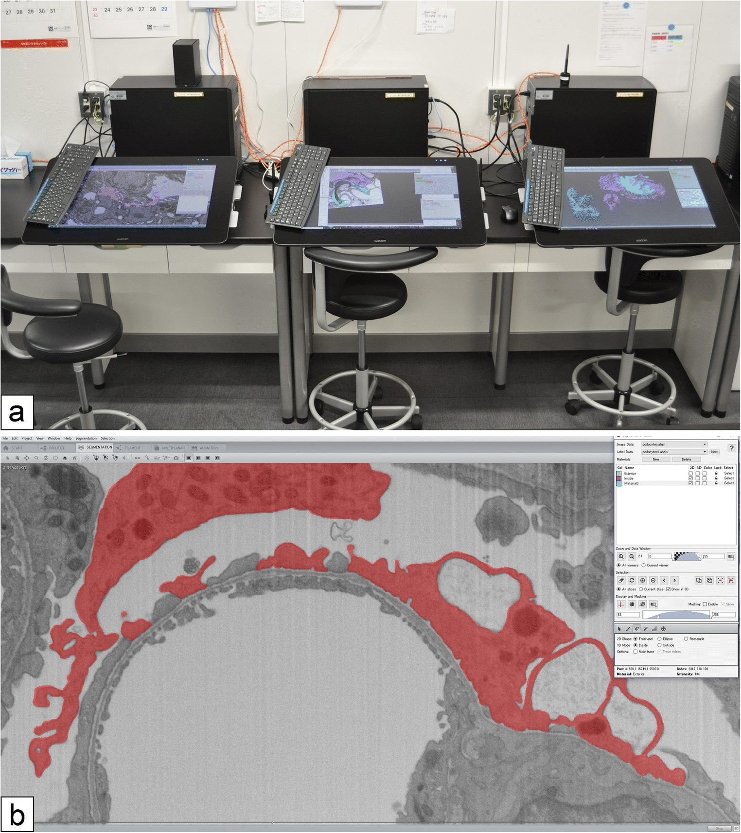 Three-dimensional imaging of podocyte ultrastructure using FE-SEM and ...