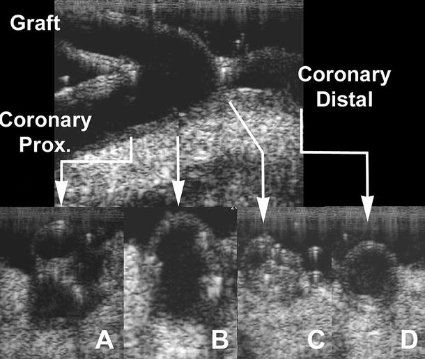 High-frequency epicardial ultrasound: review of a multipurpose ...