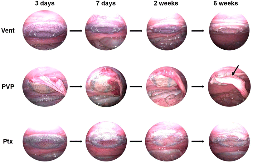 Intraperitoneal behaviour of a new composite mesh (Parietex™ Composite ...