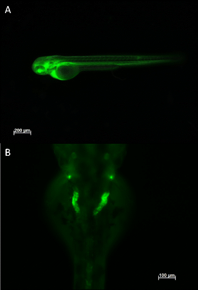 Zebrafish as a model for kidney function and disease | SpringerLink
