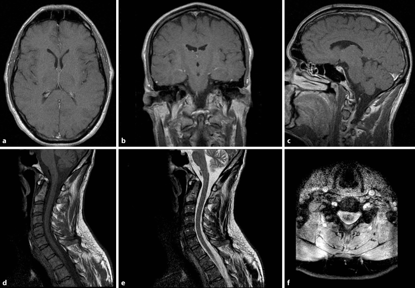 Münzkopfschmerz | SpringerLink