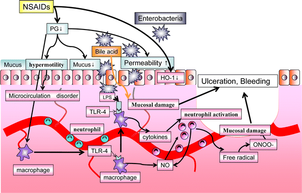 Present status and strategy of NSAIDs-induced small bowel injury ...