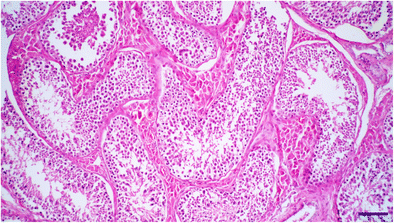 Diffuse type testicular seminoma in a stallion | SpringerLink