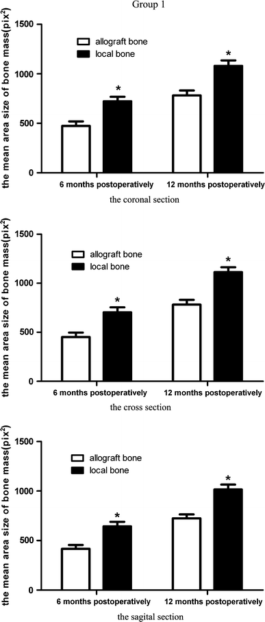 Comparing the process of creeping substitution between allograft bone ...