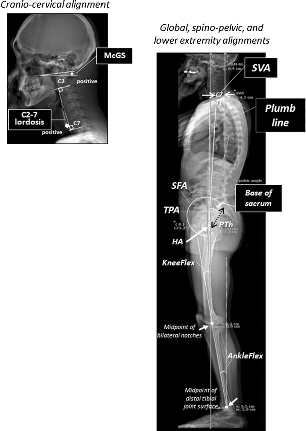Normative values of spino-pelvic sagittal alignment, balance, age, and ...
