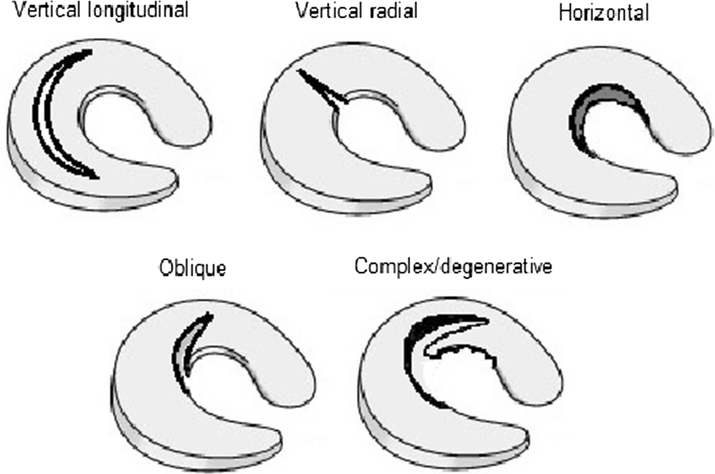 Current concepts in the techniques, indications and outcomes of ...