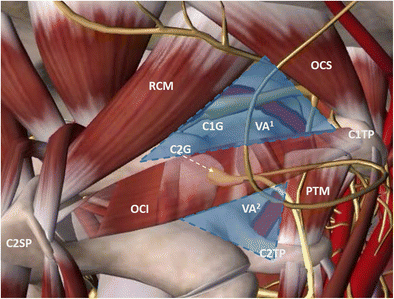 Anatomical study of occipital triangles: the ‘ inferior’ suboccipital ...