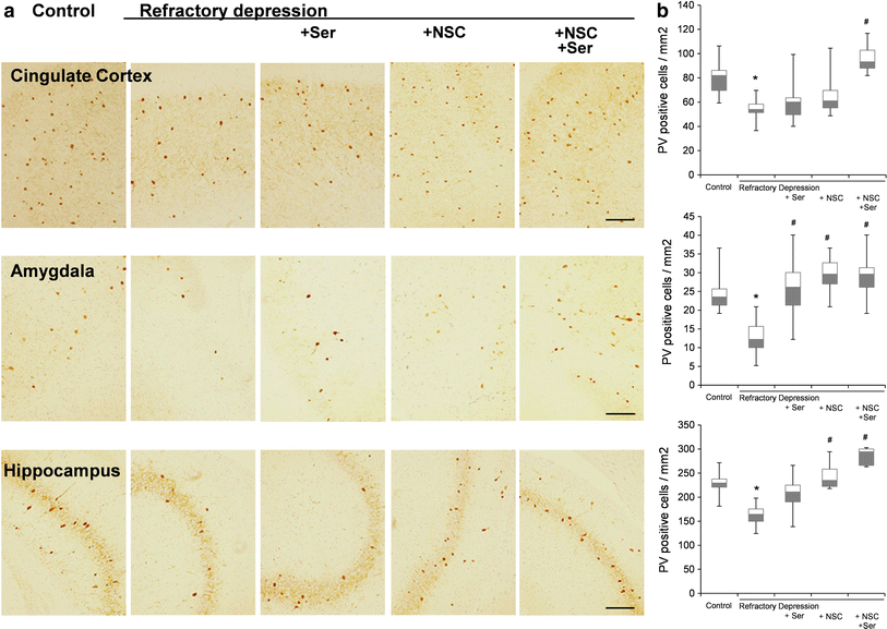 Stem cell therapy: a new approach to the treatment of refractory ...