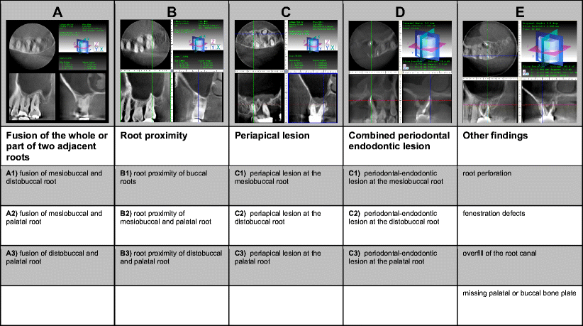 Periodontal surgery in furcation-involved maxillary molars revisited—an ...