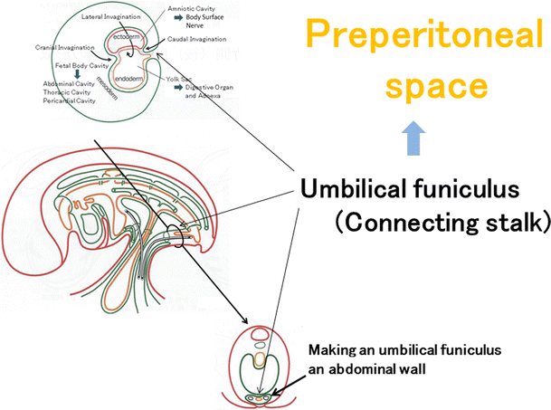 Paradigm shift regarding the transversalis fascia, preperitoneal space ...