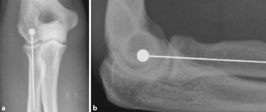 Unterarm und Handgelenk | SpringerLink