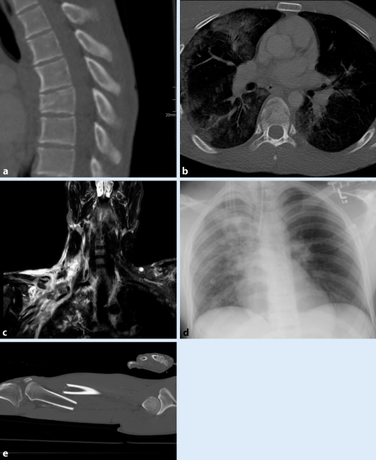 Damage-Control-Konzepte | SpringerLink