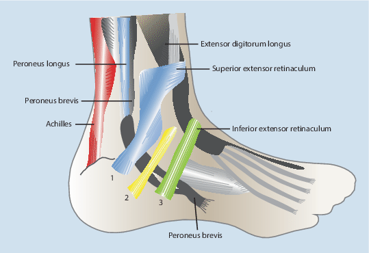 Begutachtung der Peronealsehnenluxation | SpringerLink