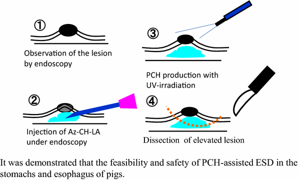 Application of hydrogels as submucosal fluid cushions for endoscopic ...