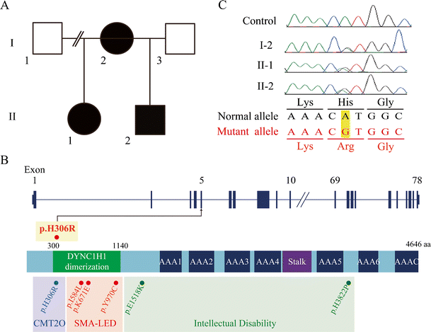 A DYNC1H1 mutation causes a dominant spinal muscular atrophy with lower ...