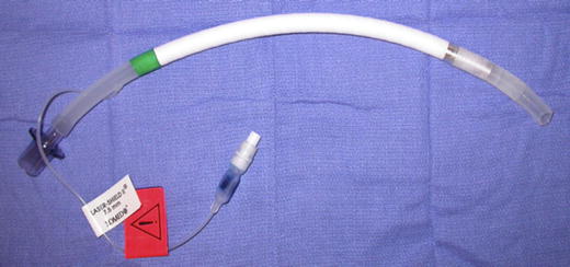 Transoral laser microsurgery for laryngeal cancer: A primer and review ...