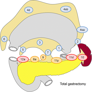 Japanese gastric cancer treatment guidelines 2014 (ver. 4) | SpringerLink