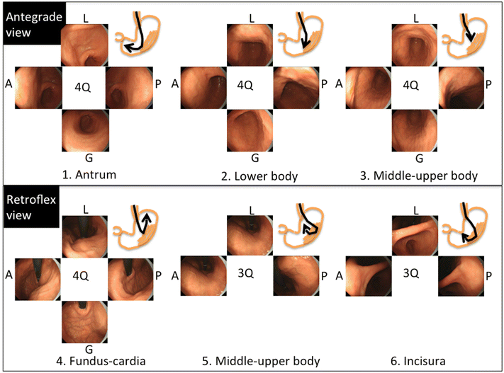 Development of an e-learning system for teaching endoscopists how to ...