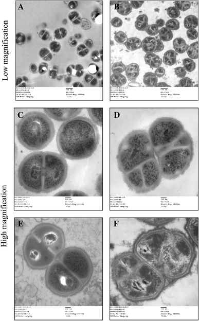 Impact of anaerobic and oligotrophic conditions on survival of ...