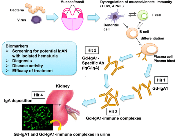 Biomarkers for IgA nephropathy on the basis of multi-hit pathogenesis ...
