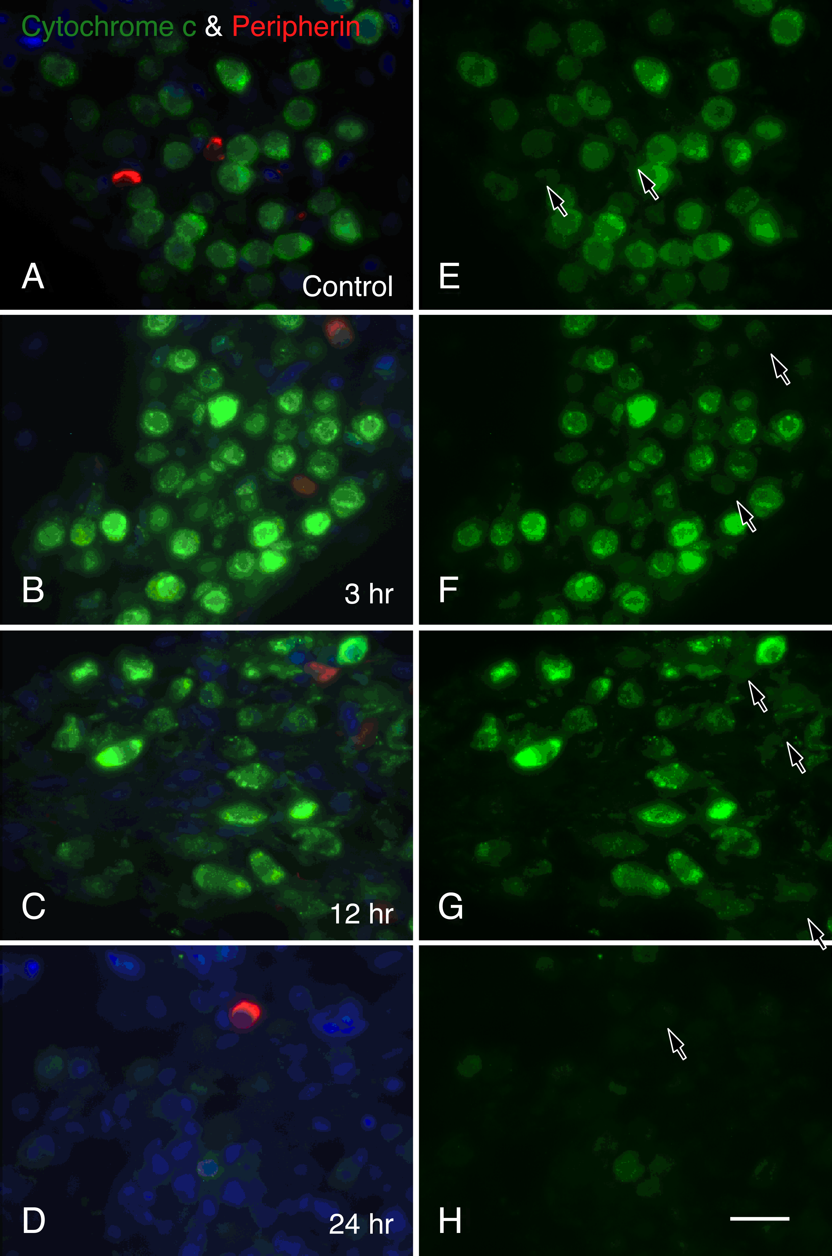 Ouabain Induces Apoptotic Cell Death in Type I Spiral Ganglion Neurons ...