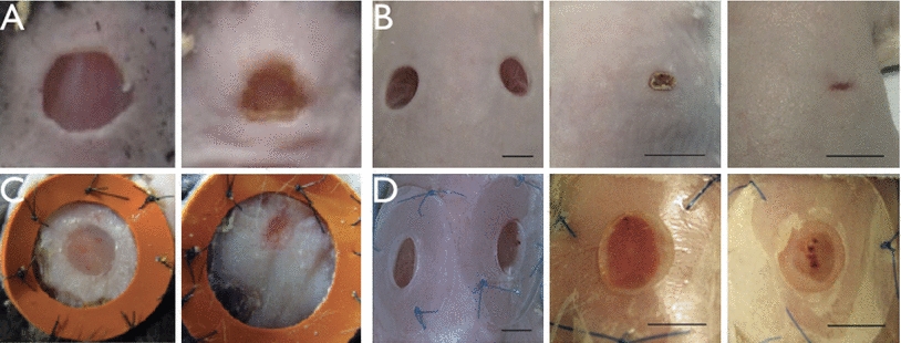 Growth and remodelling for profound circular wounds in skin | SpringerLink