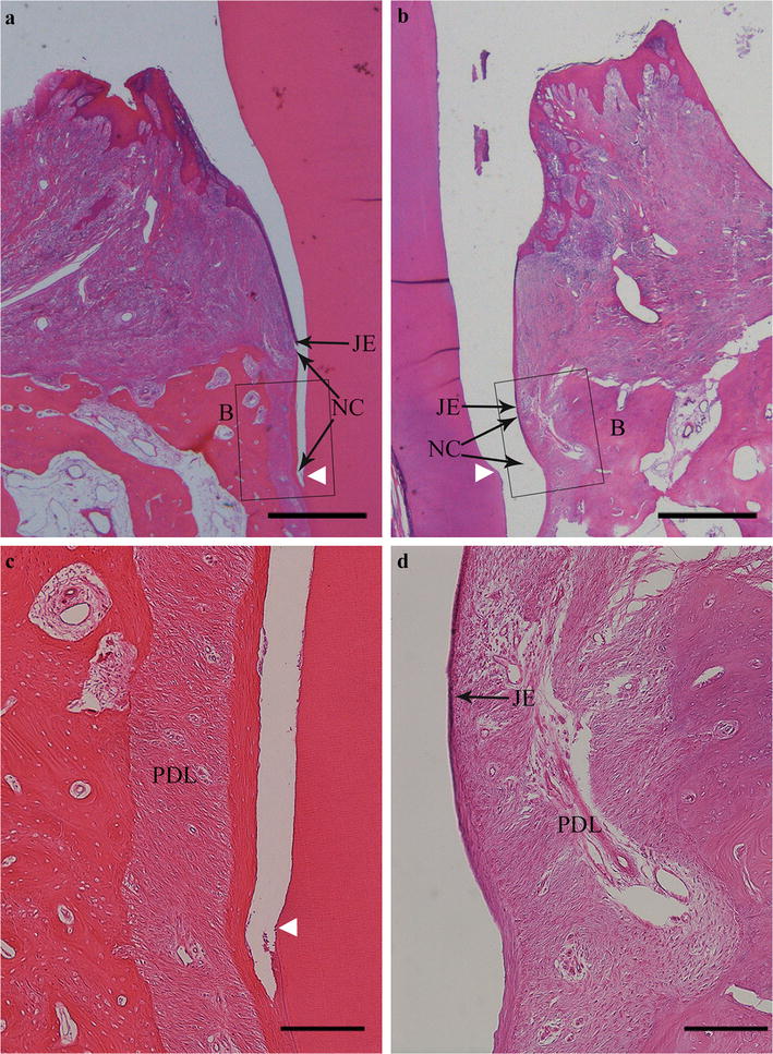 Histological healing after nonsurgical periodontal treatment with ...