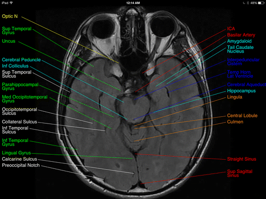 Review of “Brain MRI Atlas” App for the iPad | SpringerLink