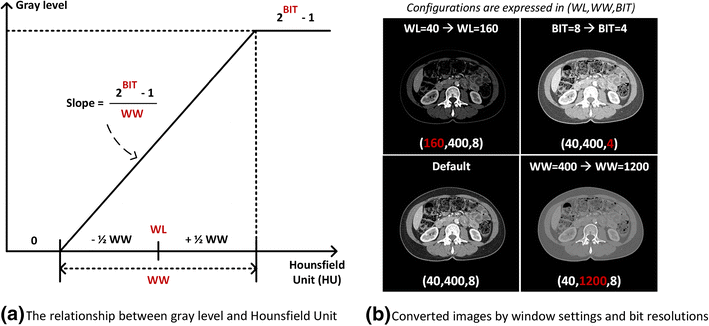 Pixel-Level Deep Segmentation: Artificial Intelligence Quantifies Muscle on Computed Tomography ...
