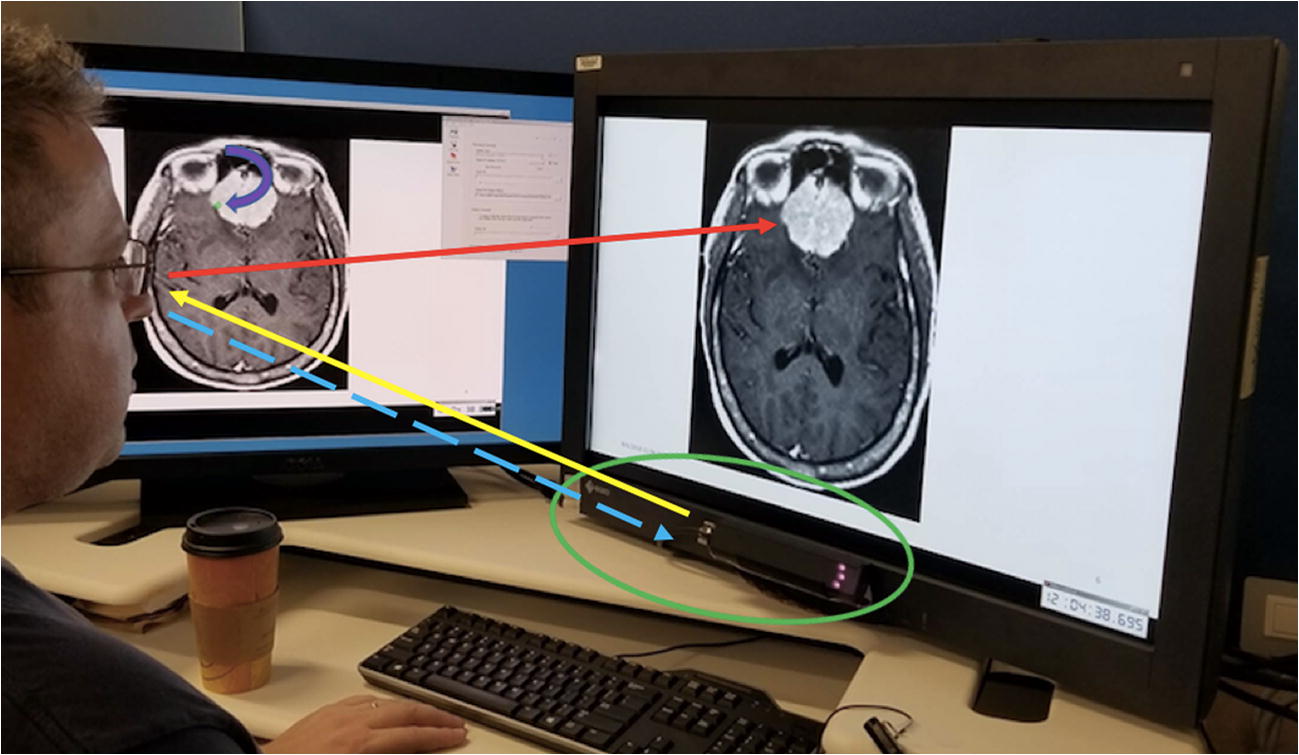 Eye Tracking for Deep Learning Segmentation Using Convolutional Neural Networks | SpringerLink
