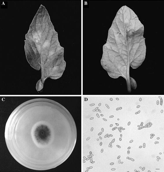 First report of races 2.5 and 2.4.5 of Cladosporium fulvum (syn ...