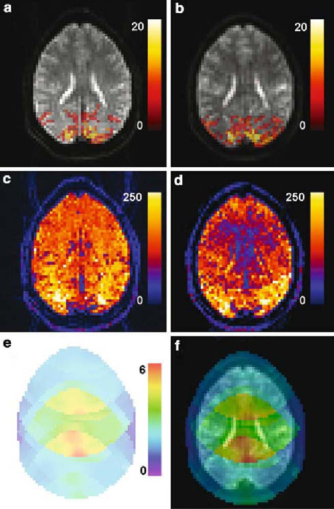 Fast spin echo sequences for BOLD functional MRI | SpringerLink