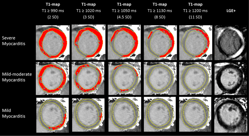 State-of-the-art review: stress T1 mapping—technical considerations ...