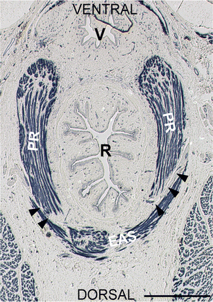 Is the Puborectalis Muscle Part of the Levator Ani Muscle? | SpringerLink