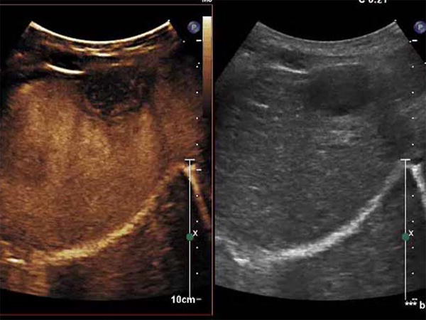 The state of ultrasound technology in the diagnosis and treatment of ...