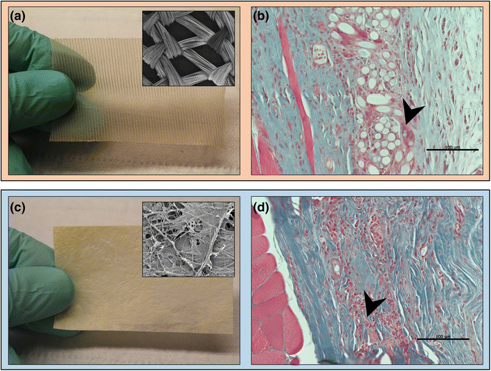 Biologic Scaffolds for Regenerative Medicine: Mechanisms of In vivo ...